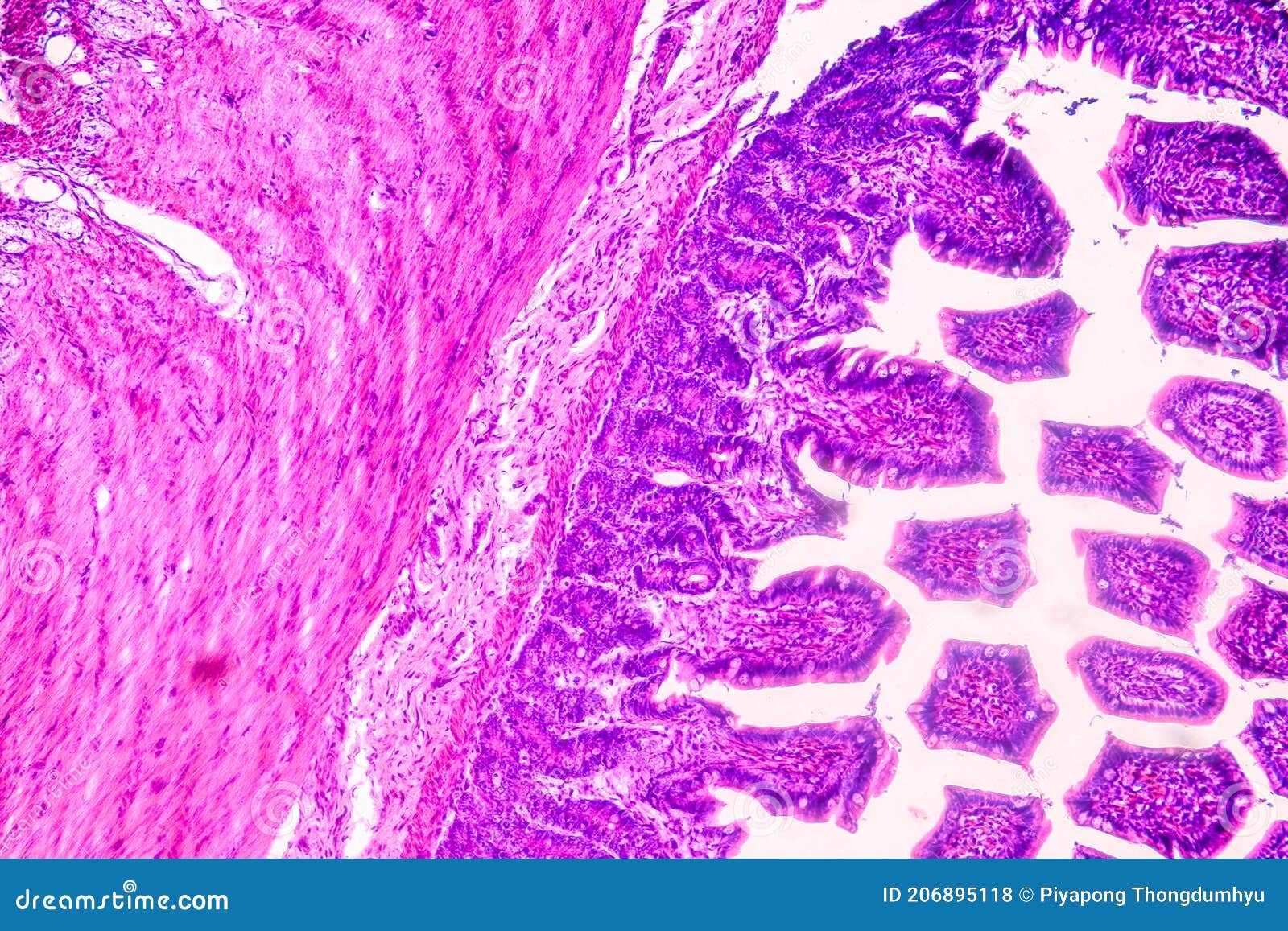 Histological Sample of Human Under the Microscope. Stock Photo - Image ...