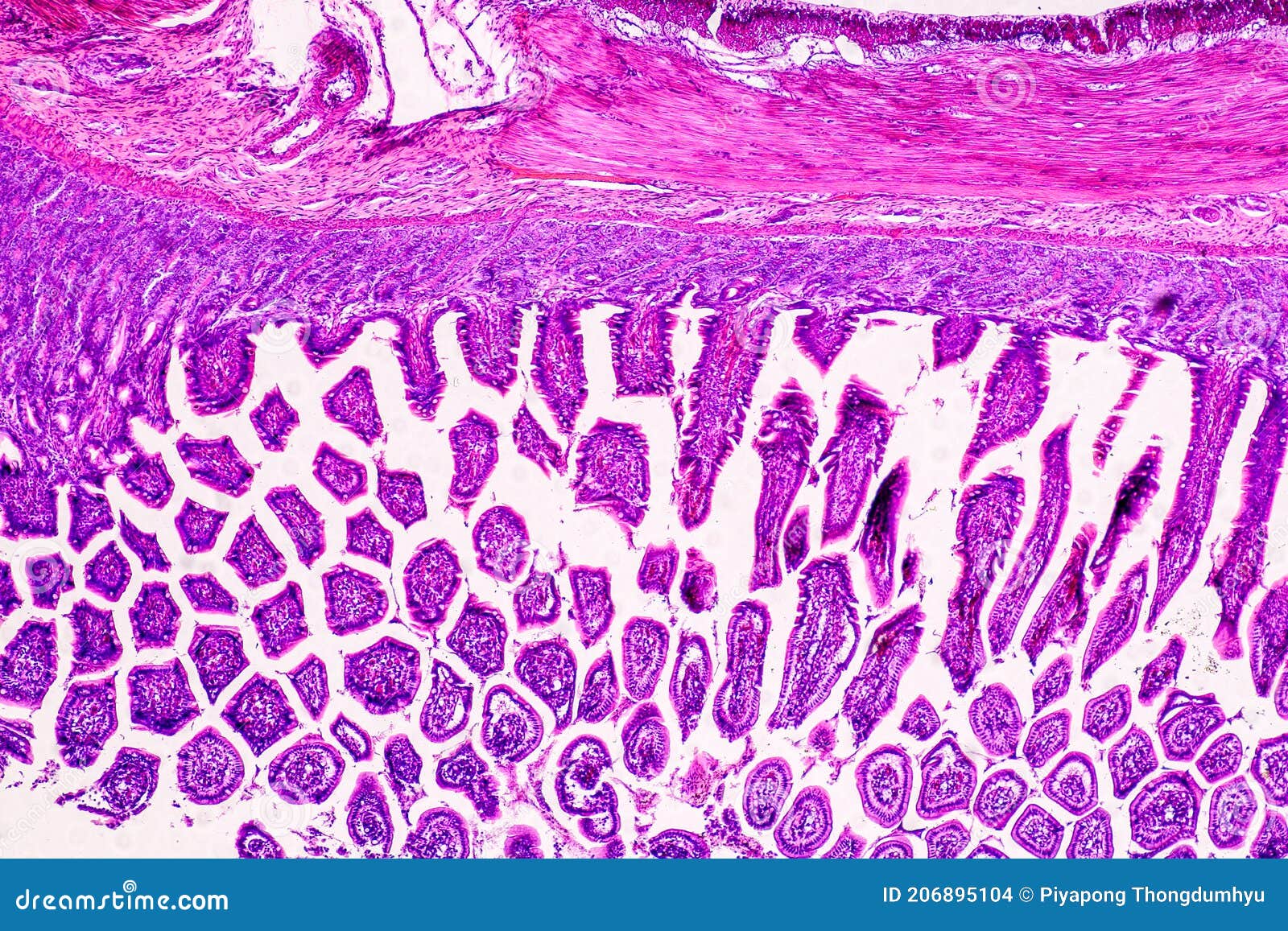 Histological Sample of Human Under the Microscope. Stock Photo - Image ...