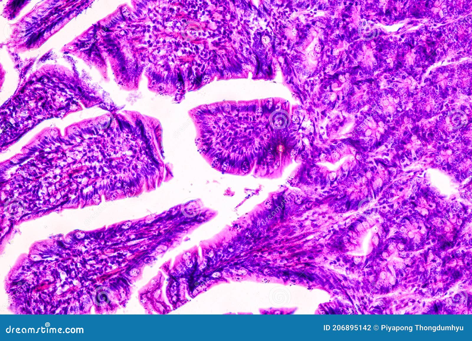 Histological Sample of Human Under the Microscope. Stock Photo - Image ...