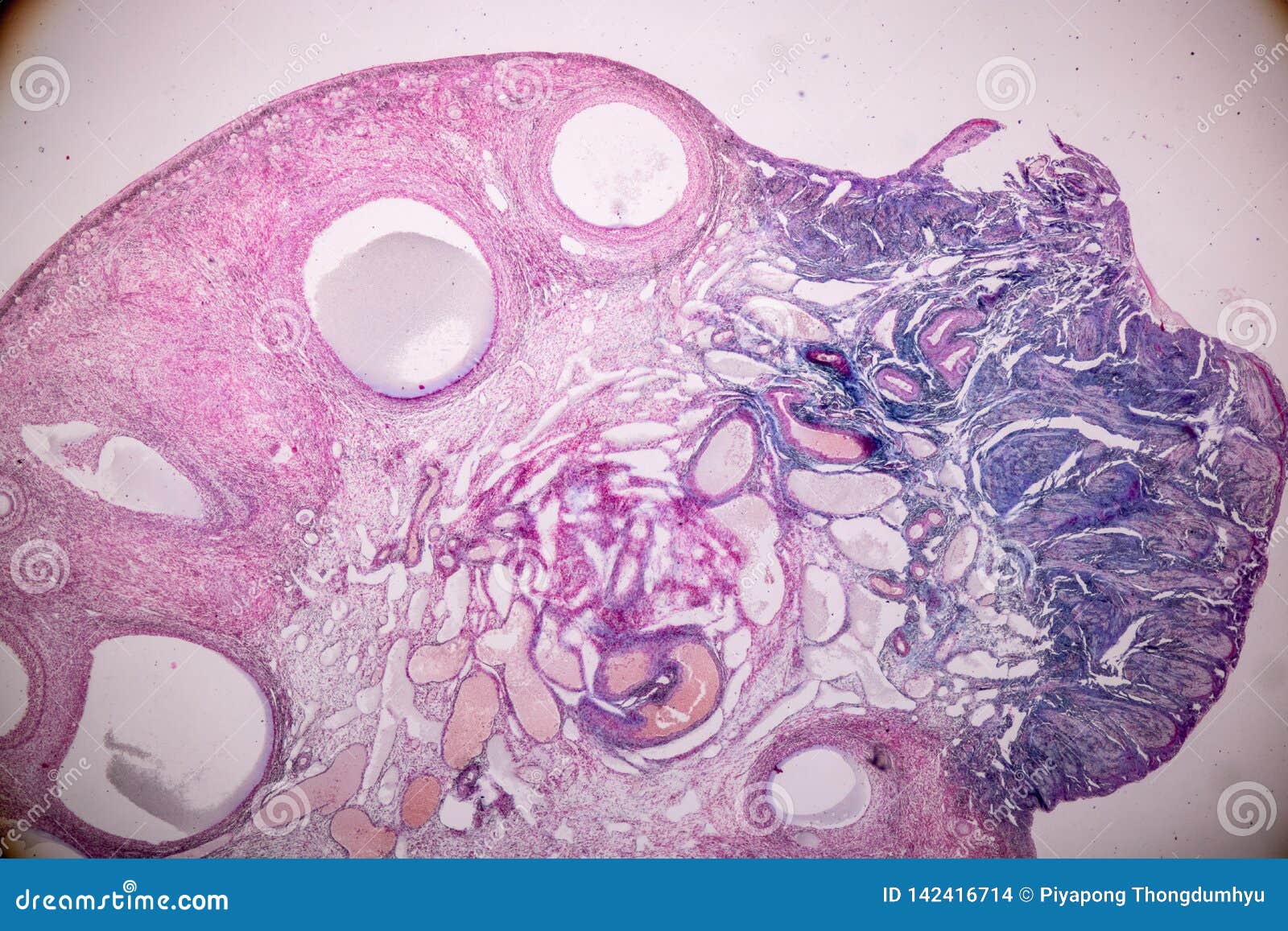 Histological Sample Ovary of Rabbit Tissue Under the Microscope. Stock ...