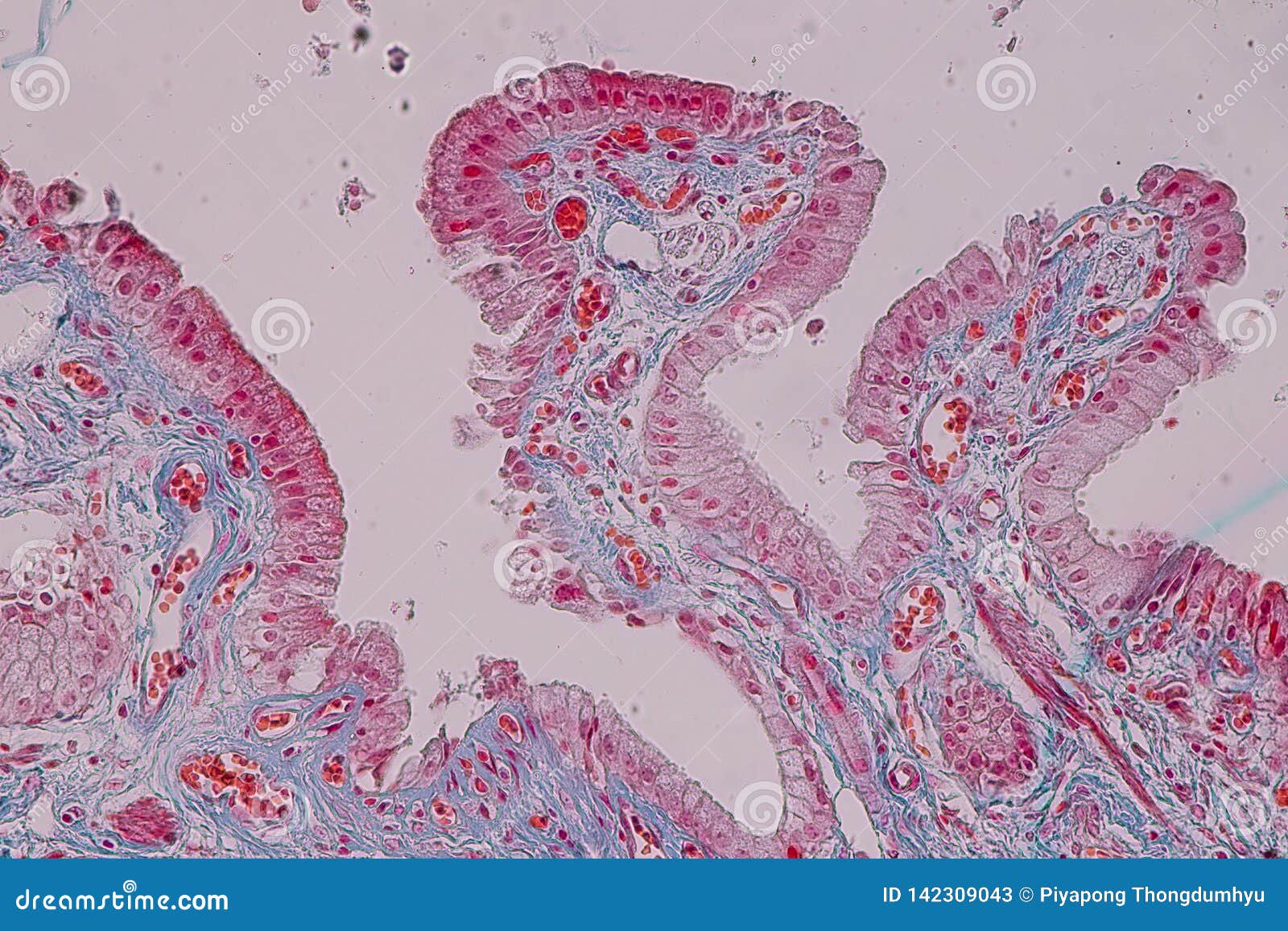 Histological Sample Simple Columnar Epithelium Tissue Under The ...