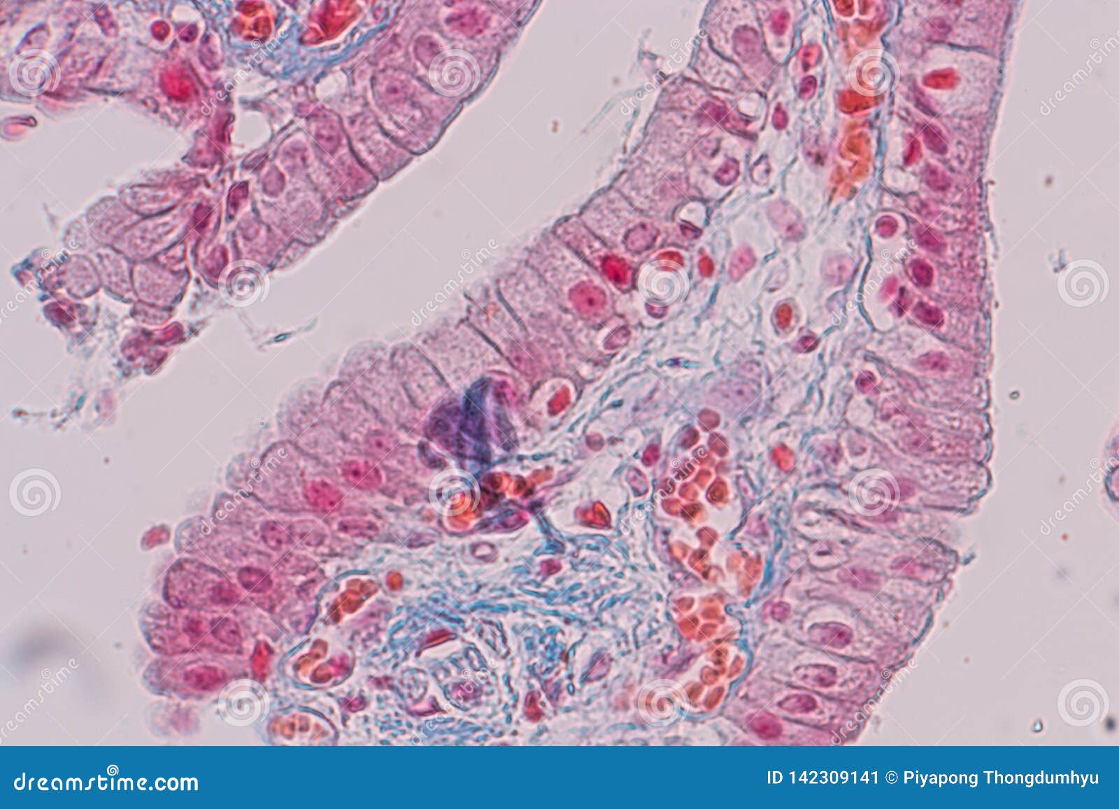 Simple Columnar Epithelium Under Microscope Simple Columnar Epithelium Under Microscope