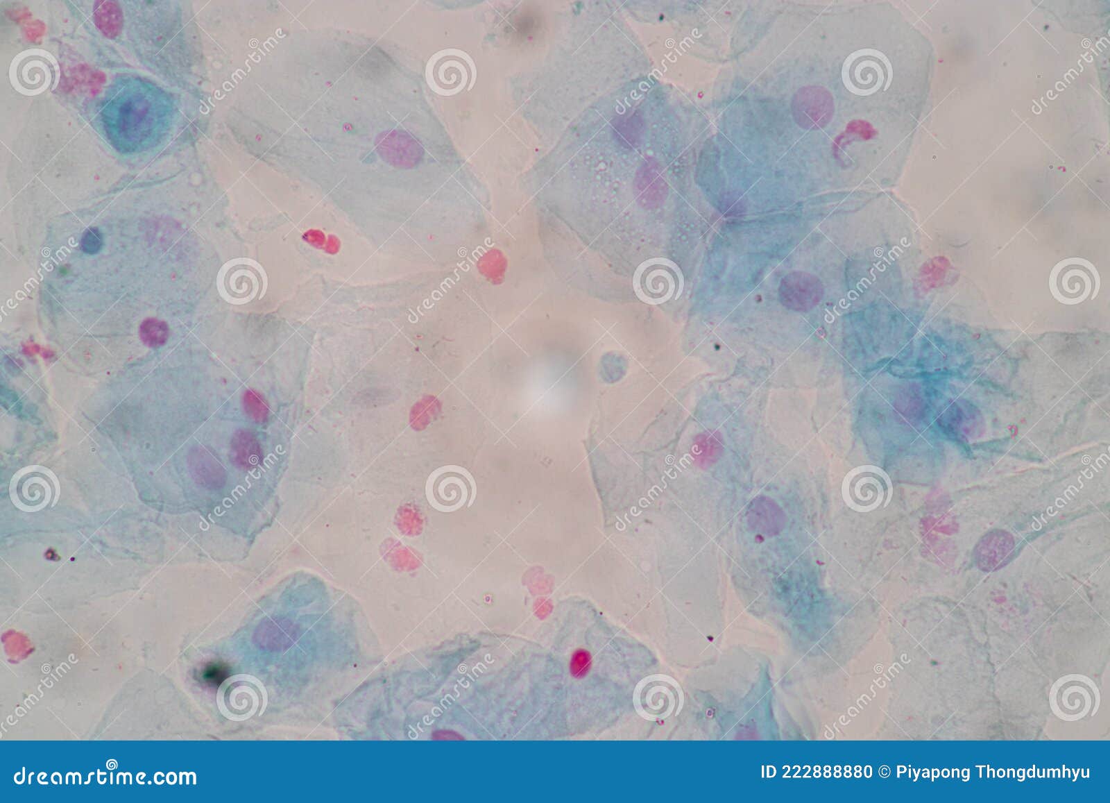 Histological Sample Squamous Epithelial Cells Under Microscope. Stock ...