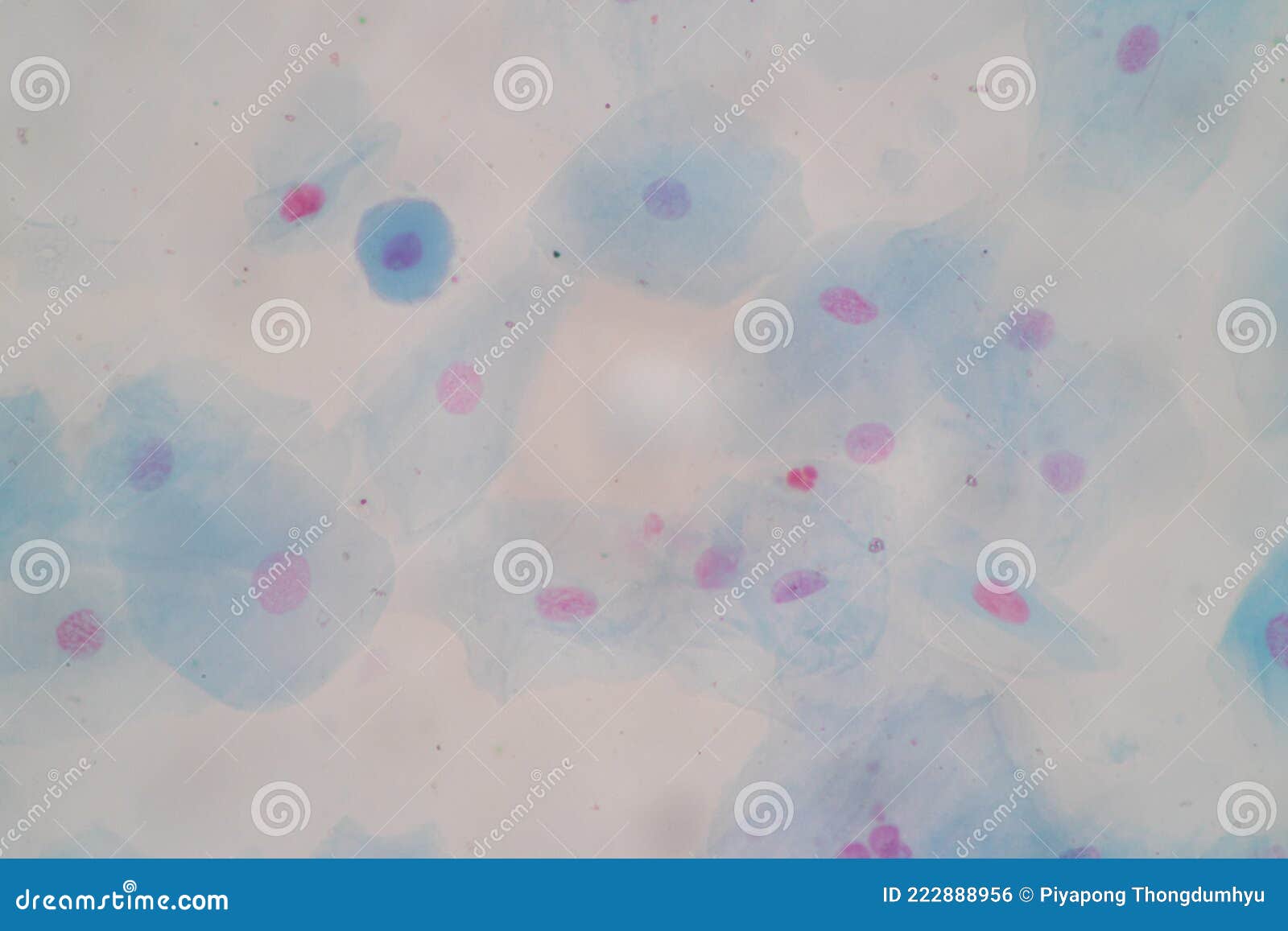 Sample Microscopy Epithelial Cells at Toby Victor blog