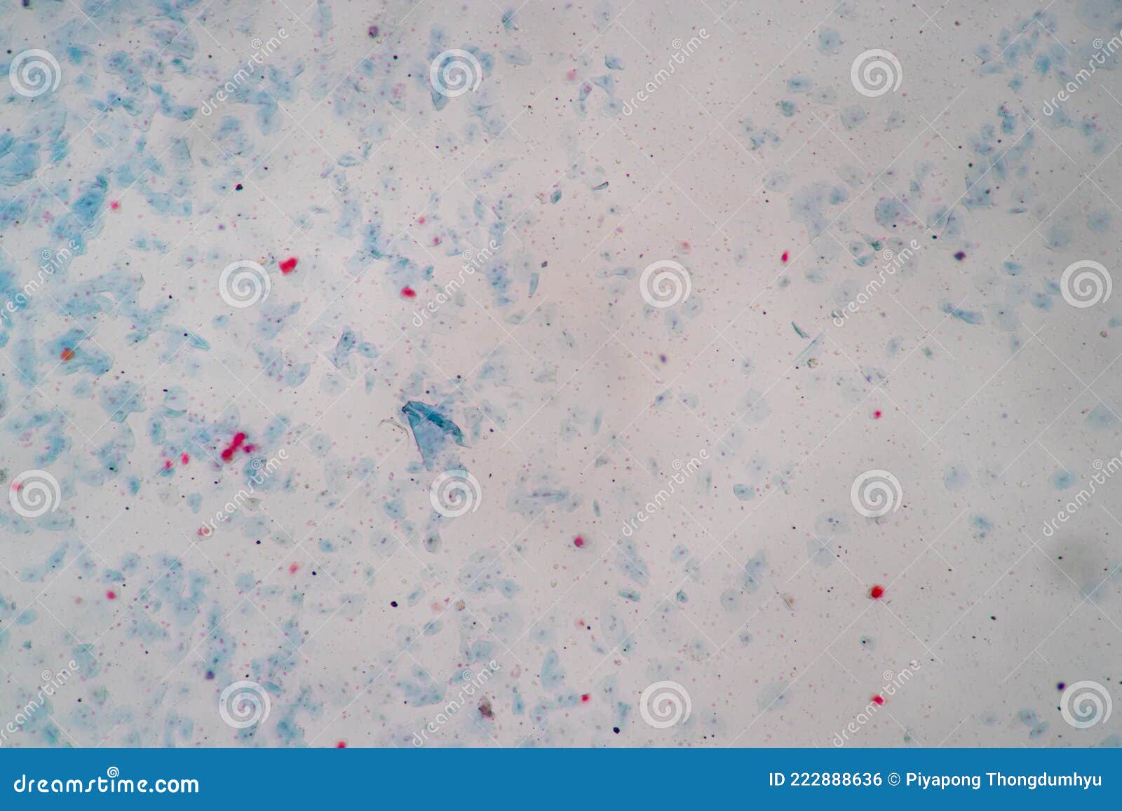 Histological Sample Squamous Epithelial Cells Under Microscope. Stock ...