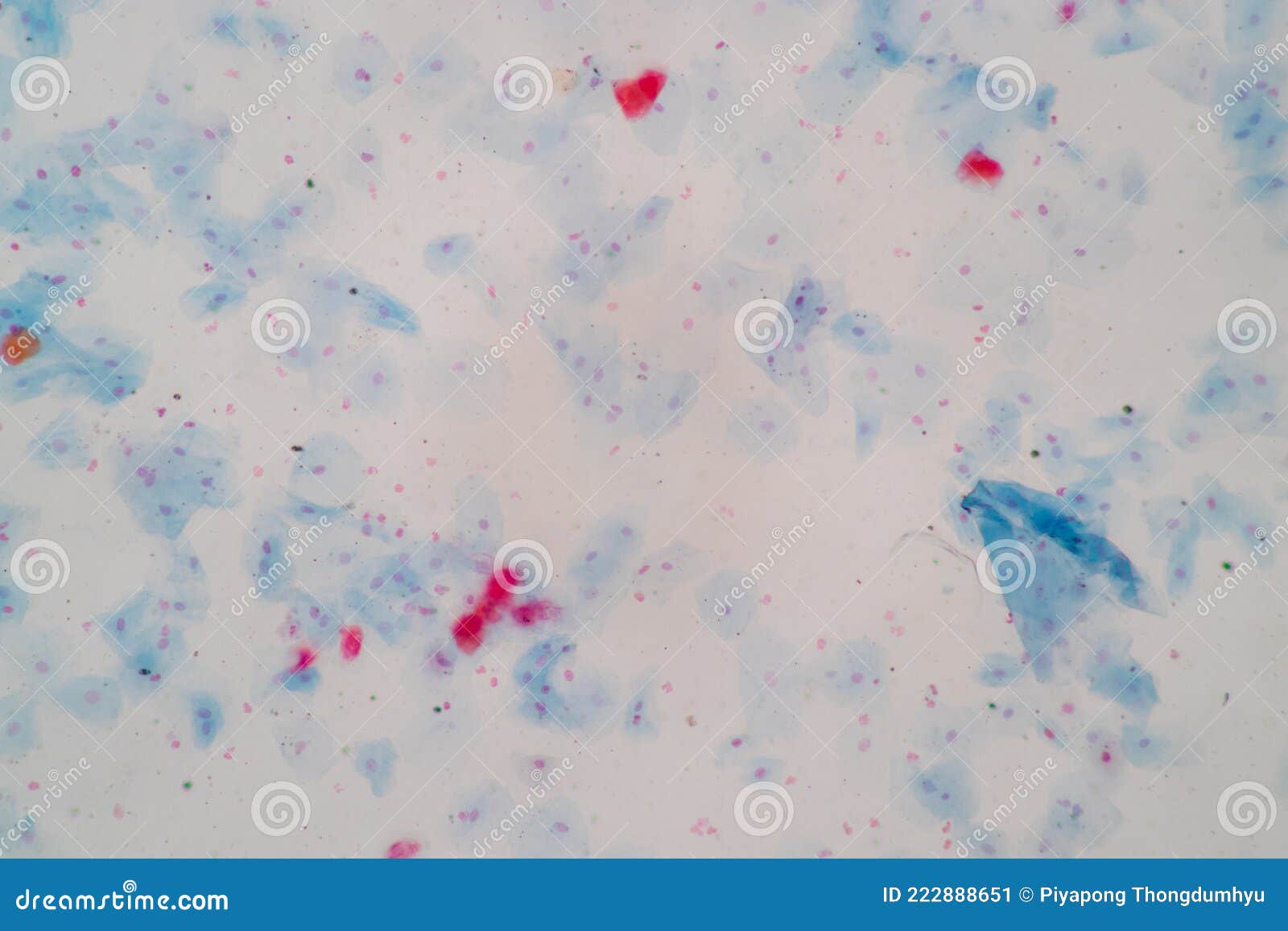 Histological Sample Squamous Epithelial Cells Under Microscope. Stock ...