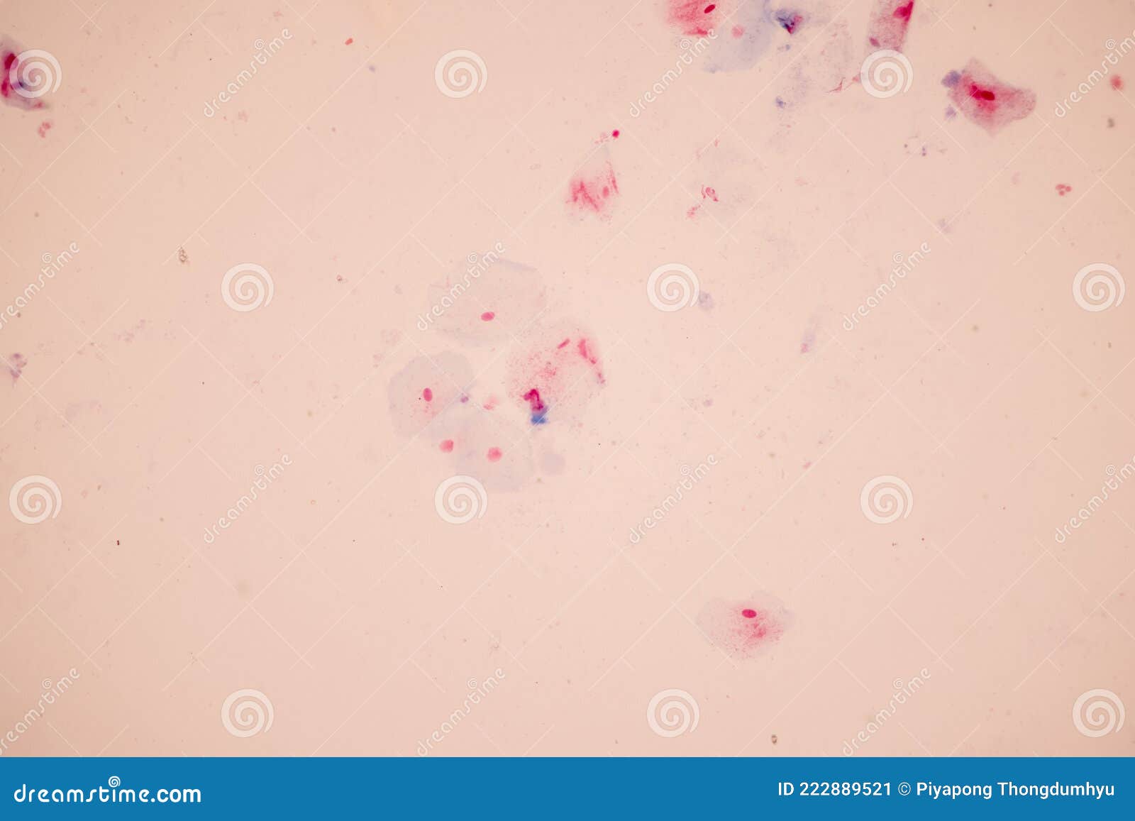 Sample Microscopy Epithelial Cells at Toby Victor blog