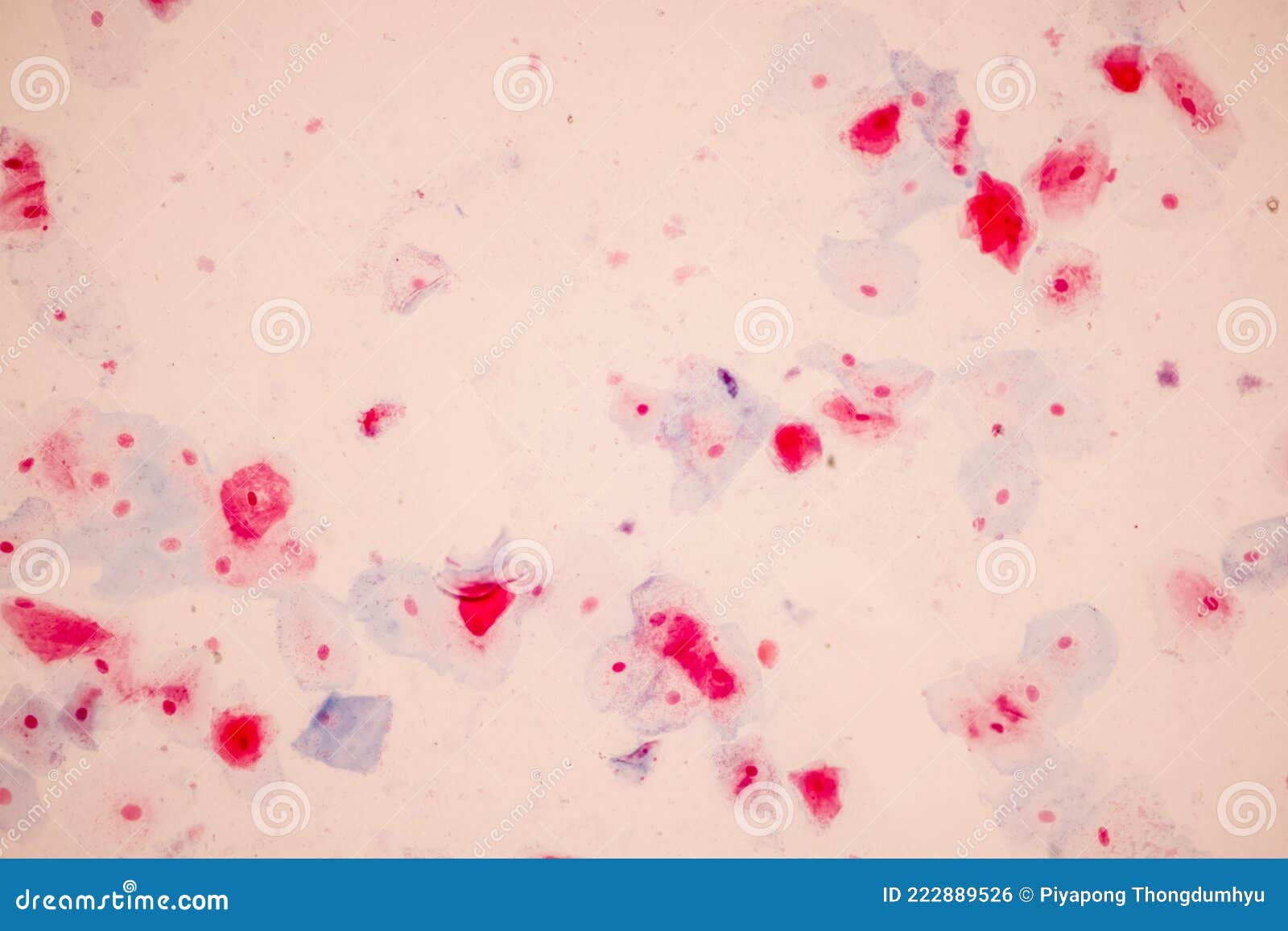 Sample Microscopy Epithelial Cells at Toby Victor blog
