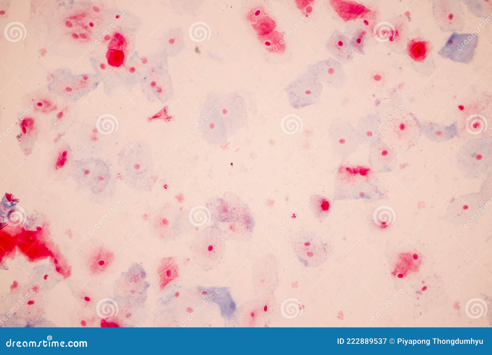 Histological Sample Squamous Epithelial Cells Under Microscope. Stock ...