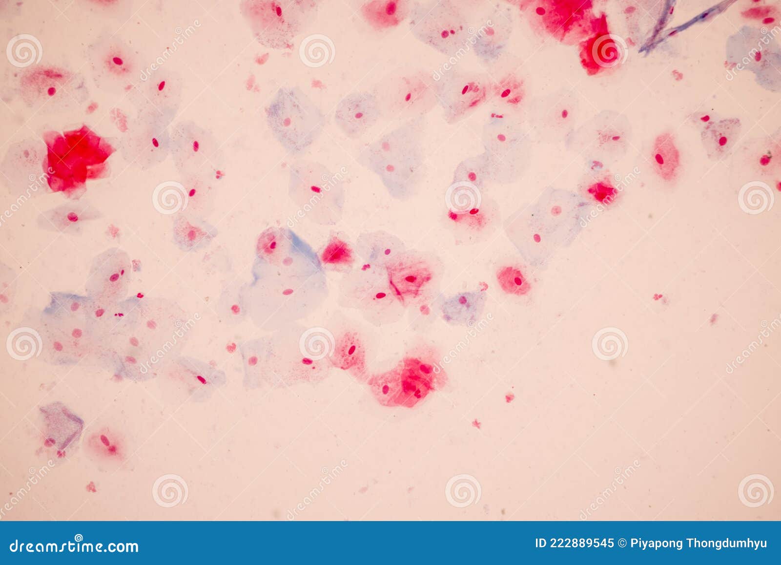 Histological Sample Squamous Epithelial Cells Under Microscope. Stock ...