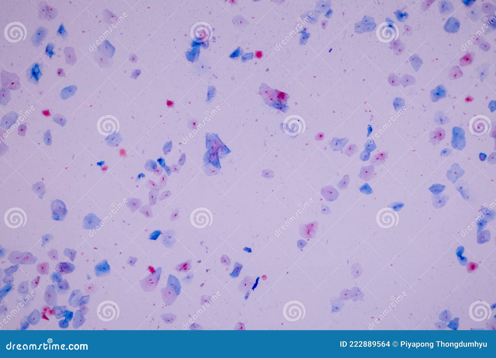 Histological Sample Squamous Epithelial Cells Under Microscope. Stock ...