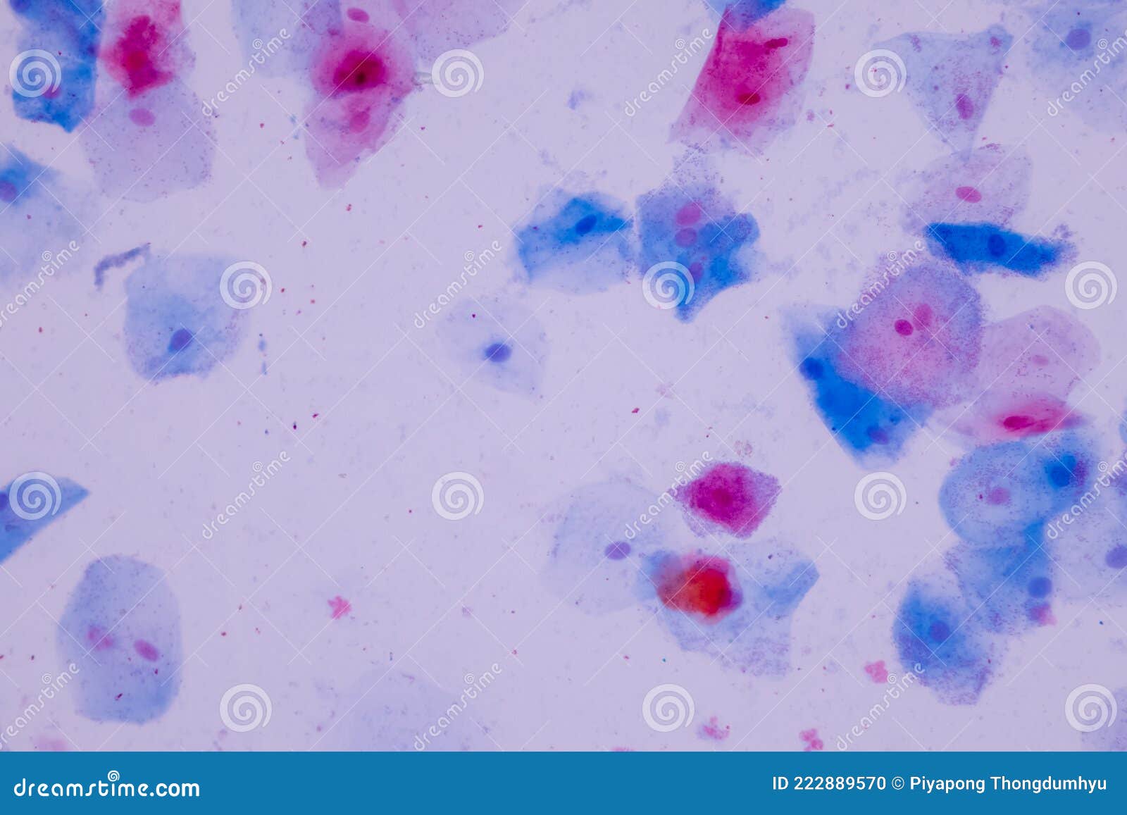 Human Epithelial Cells Under Microscope