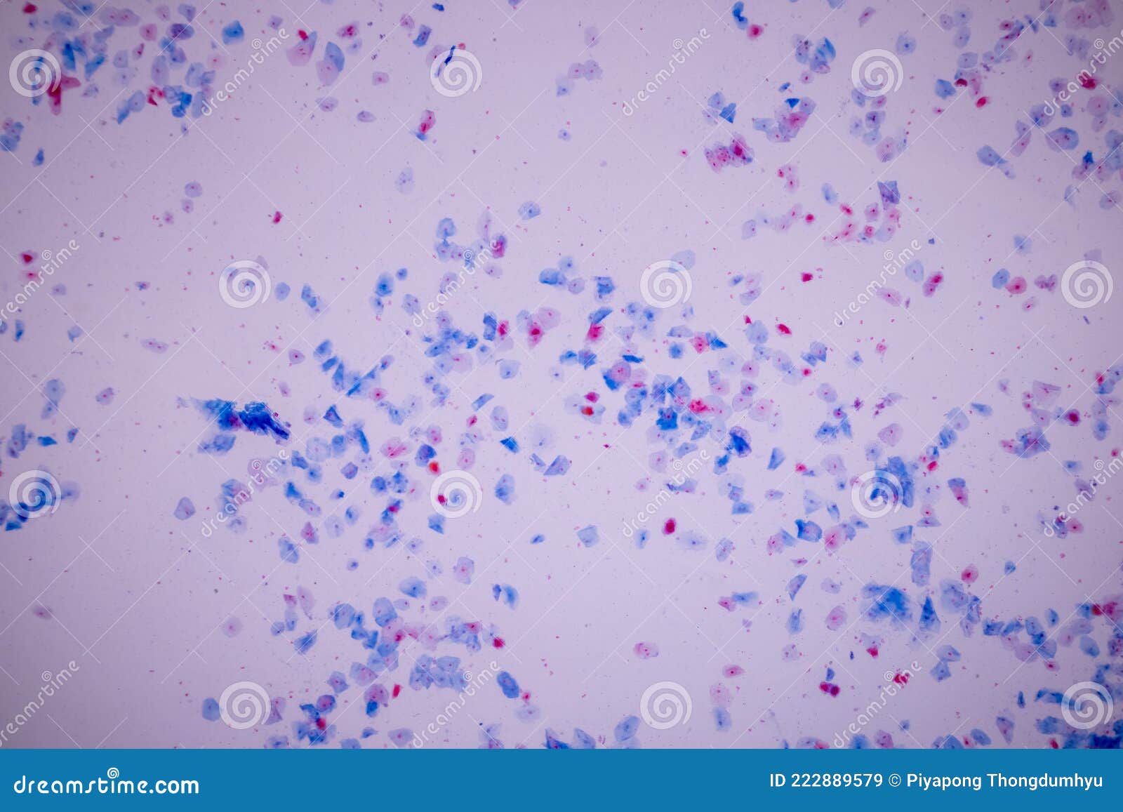 Sample Microscopy Epithelial Cells at Toby Victor blog