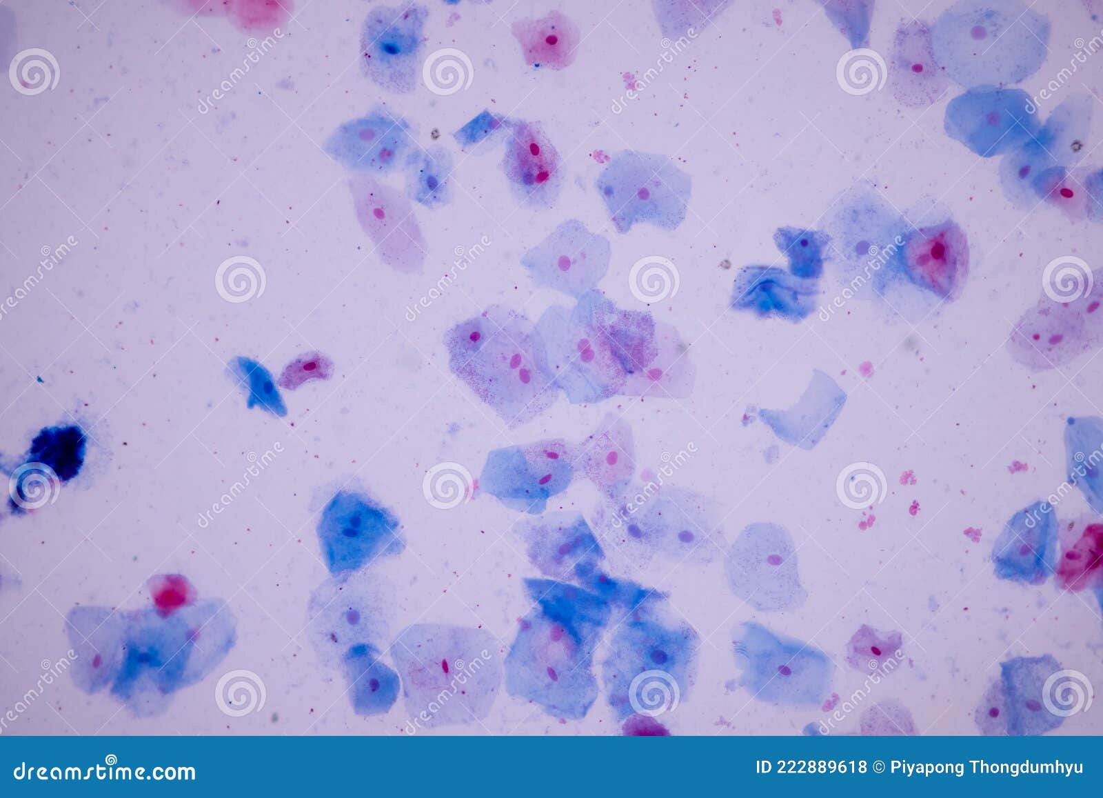 Histological Sample Squamous Epithelial Cells Under Microscope. Stock ...