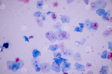 Histological Sample Squamous Epithelial Cells Under Microscope. Stock ...