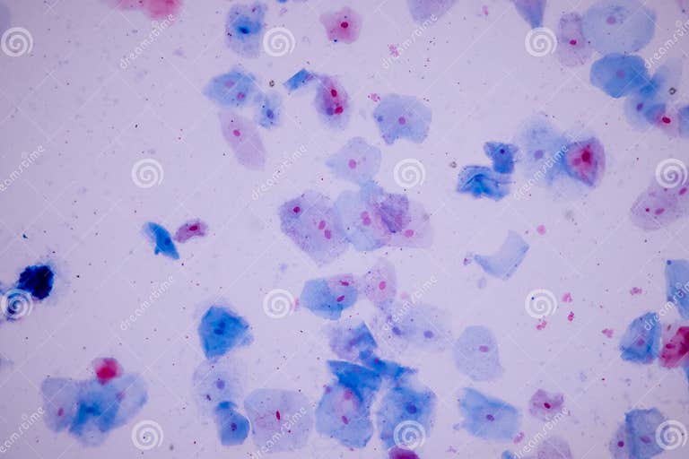 Histological Sample Squamous Epithelial Cells Under Microscope. Stock ...