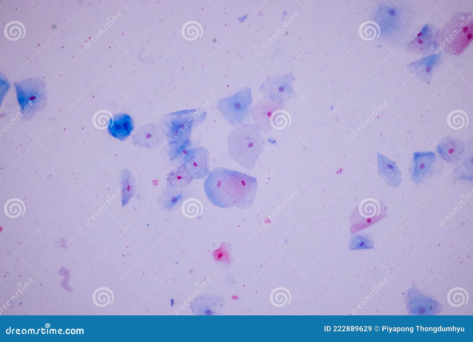 Histological Sample Squamous Epithelial Cells Under Microscope. Stock ...