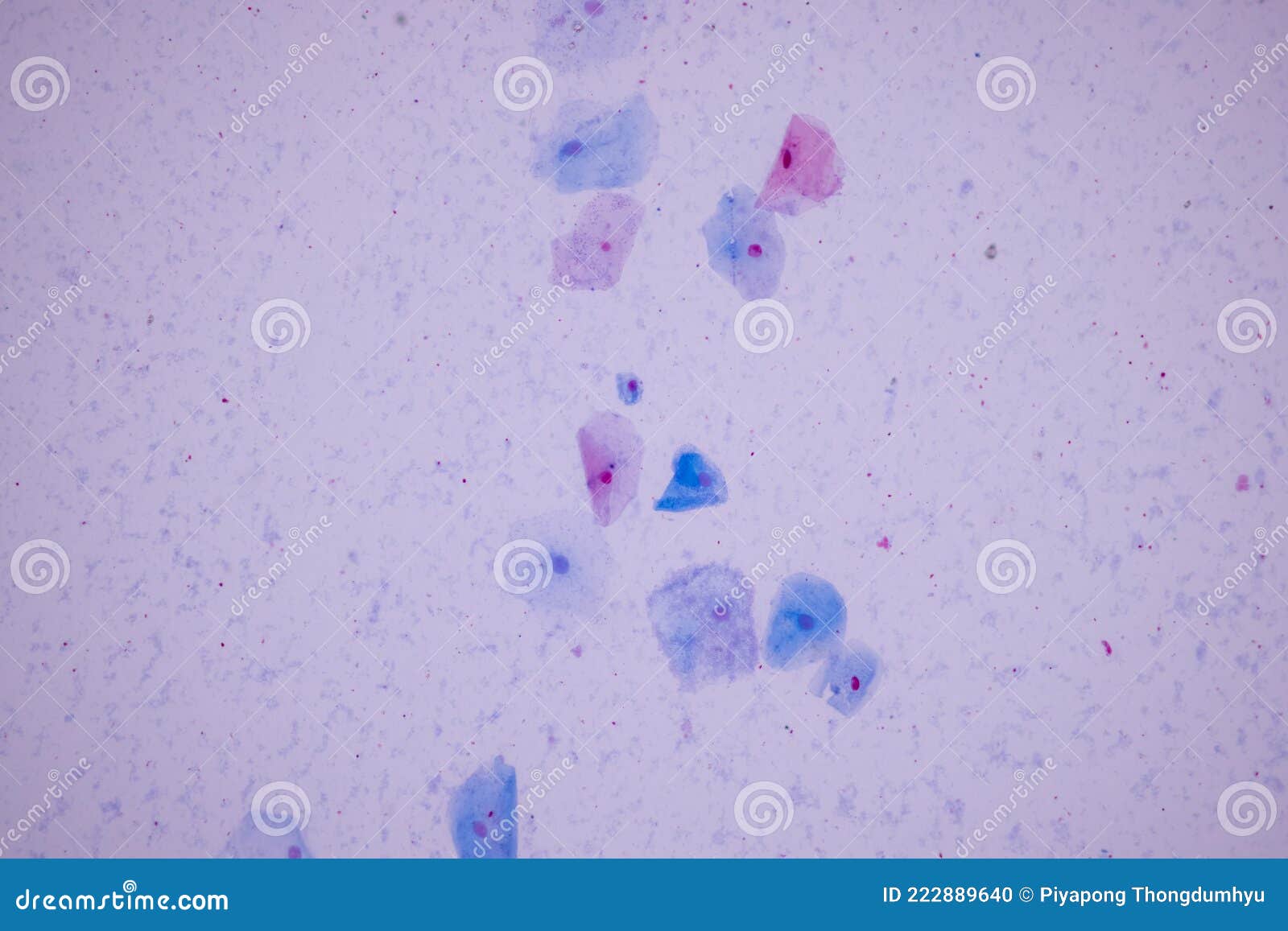 Histological Sample Squamous Epithelial Cells Under Microscope. Stock ...