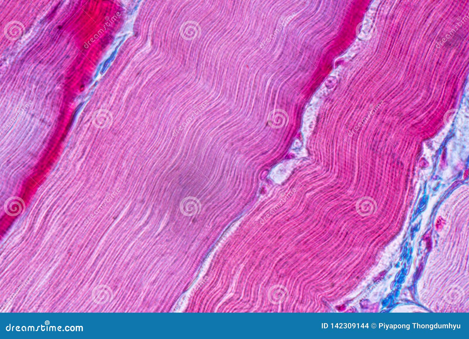 Skeletal Striated Muscle Tissue Under The Microscope Royalty-Free Stock ... Skeletal Striated Muscle Tissue Under The Microscope Royalty-Free Stock ...