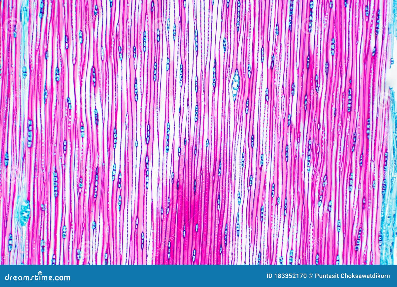 Histological Structure of Pine Stem Vascular Bundle Under Microscope ...