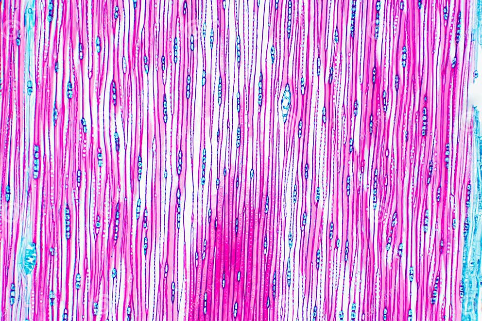 Histological Structure of Pine Stem Vascular Bundle Under Microscope ...