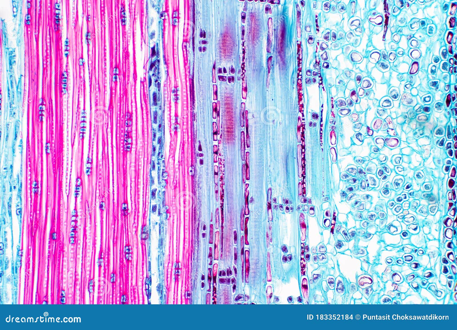 Histological Structure of Pine Stem Vascular Bundle Under Microscope ...
