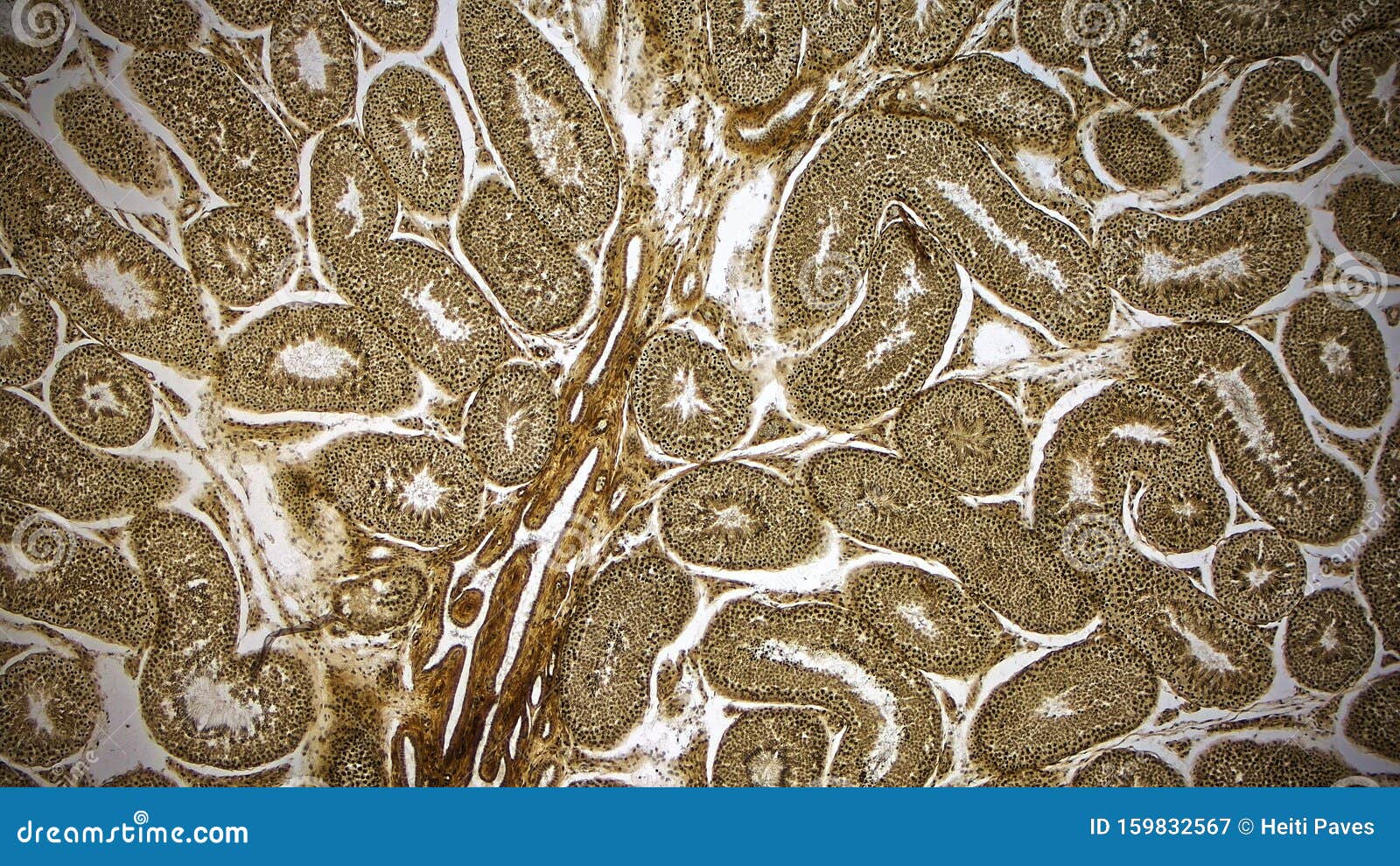 Rabbit Testicle, Cross-section Stock Image - Image of cross, histology ...