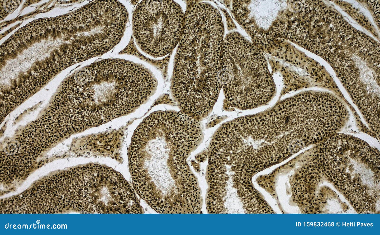 Rabbit Testicle, Cross-section Stock Photo - Image of staining ...