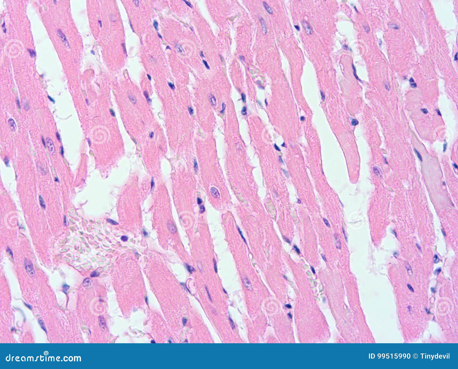 Histologie Van Hart Menselijk Weefsel Stock Foto - Image of kern ...