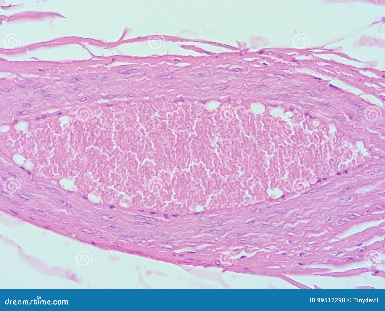 Histologie Van Hart Menselijk Weefsel Stock Foto - Image of wetenschap ...