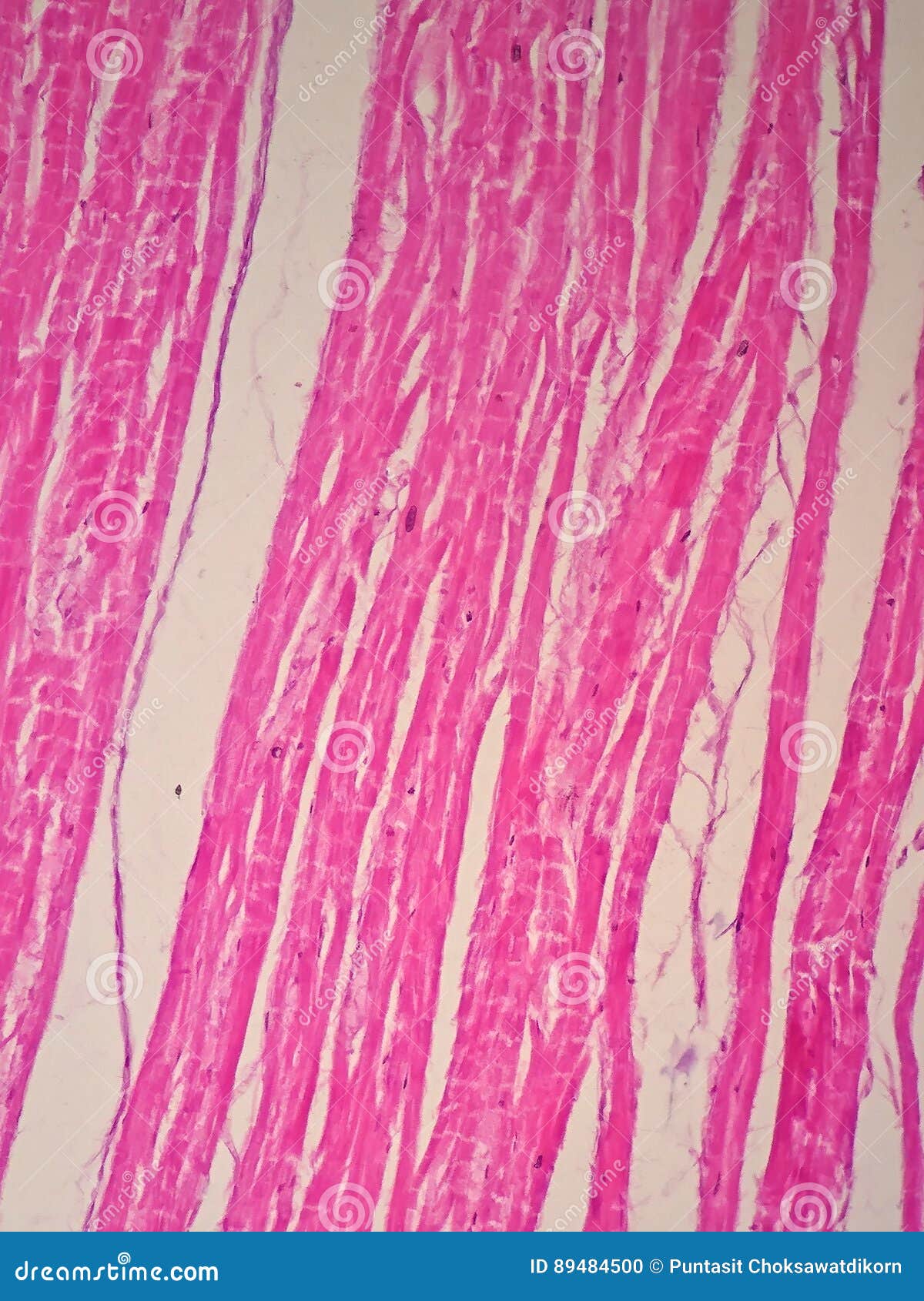 Histologie van hartspier stock illustratie. Illustration of vezels ...