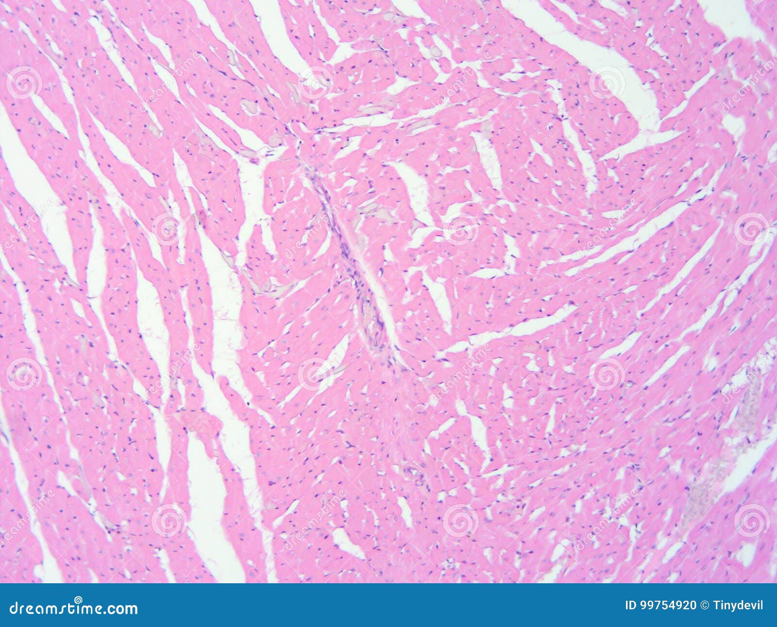 Histologie Van Het Menselijke Weefsel Van De Hartspier Stock Foto ...