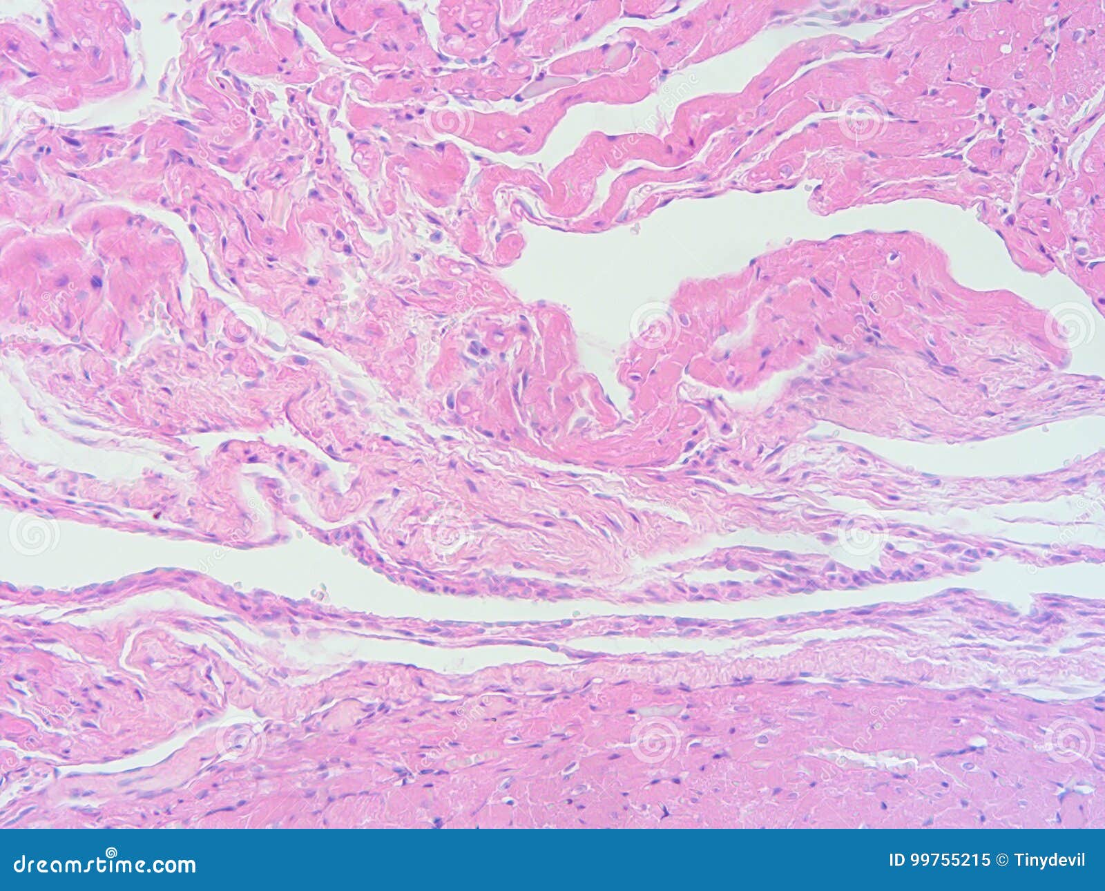 Histologie Van Het Menselijke Weefsel Van De Hartspier Stock Afbeelding ...