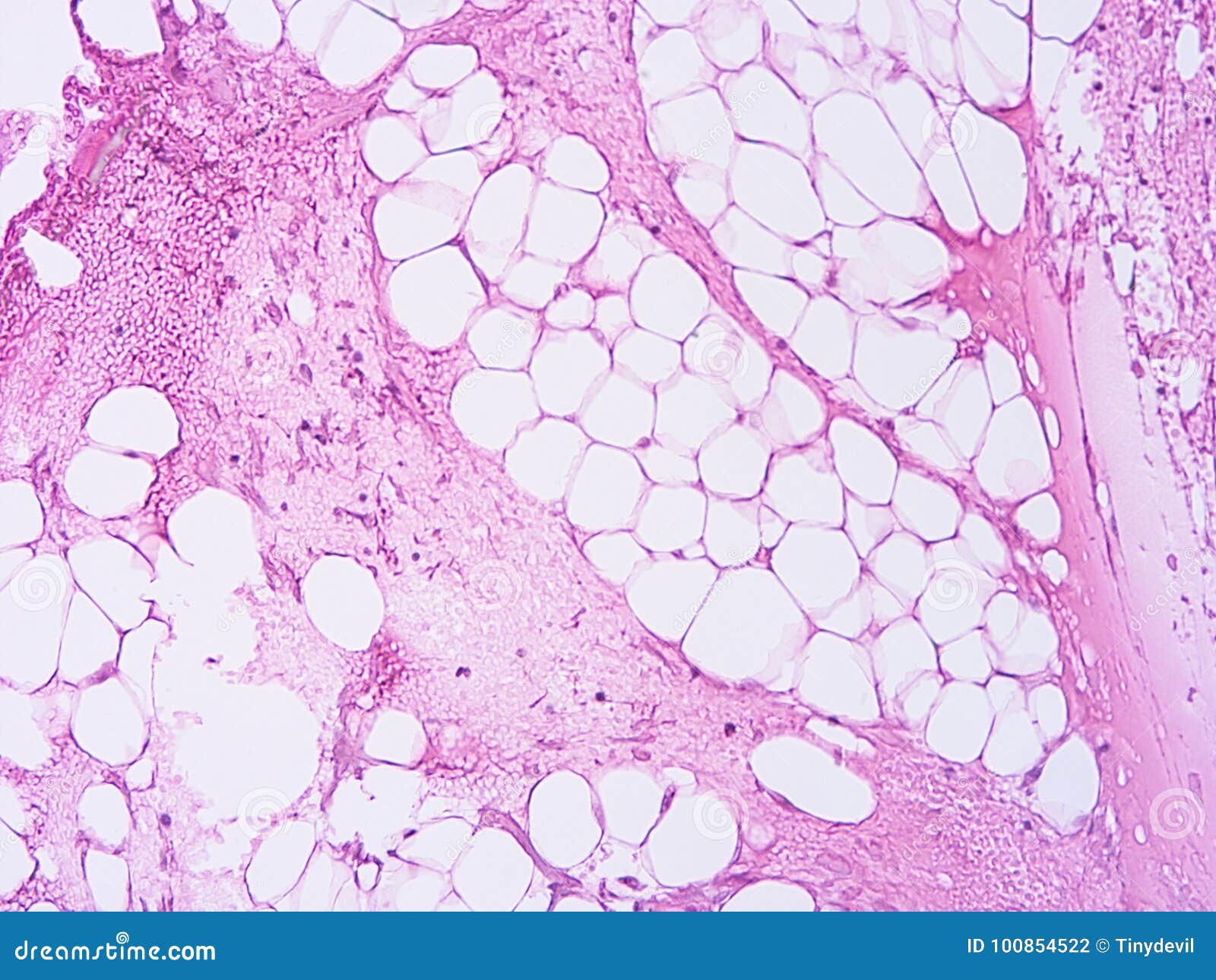 Histologie Van Menselijk Weefsel Stock Foto - Image of biologie, mening ...