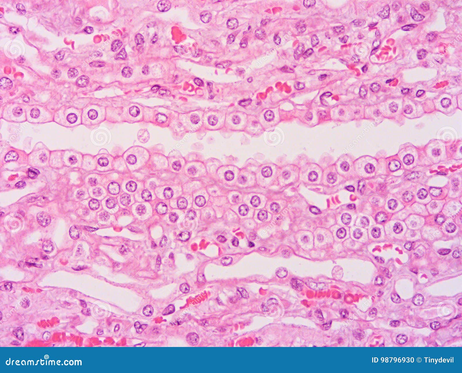 Histologie Van Menselijk Weefsel Stock Foto - Image of toon, weefsel ...