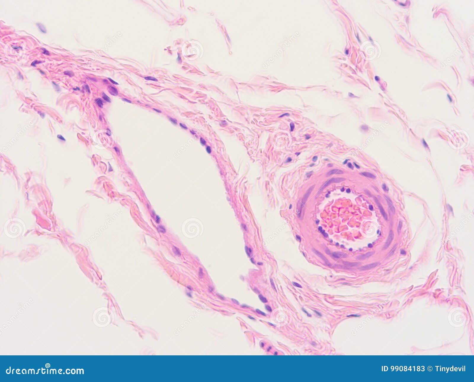 Histologie Van Menselijk Weefsel Stock Afbeelding - Image of wetenschap ...