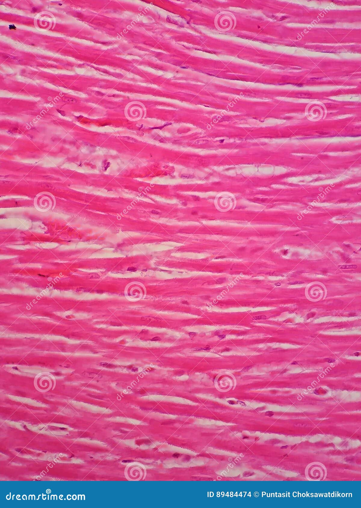 Histologie Van Menselijke Hartspier Stock Foto - Image of leven, spier ...