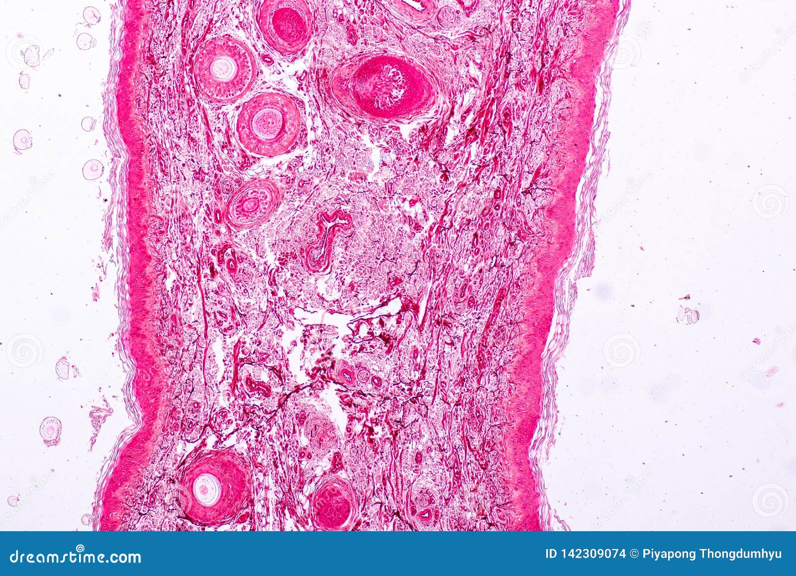 Histologisch Steekproef Elastisch Kraakbeen Tisue Onder De Microscoop Stock Foto Image Of