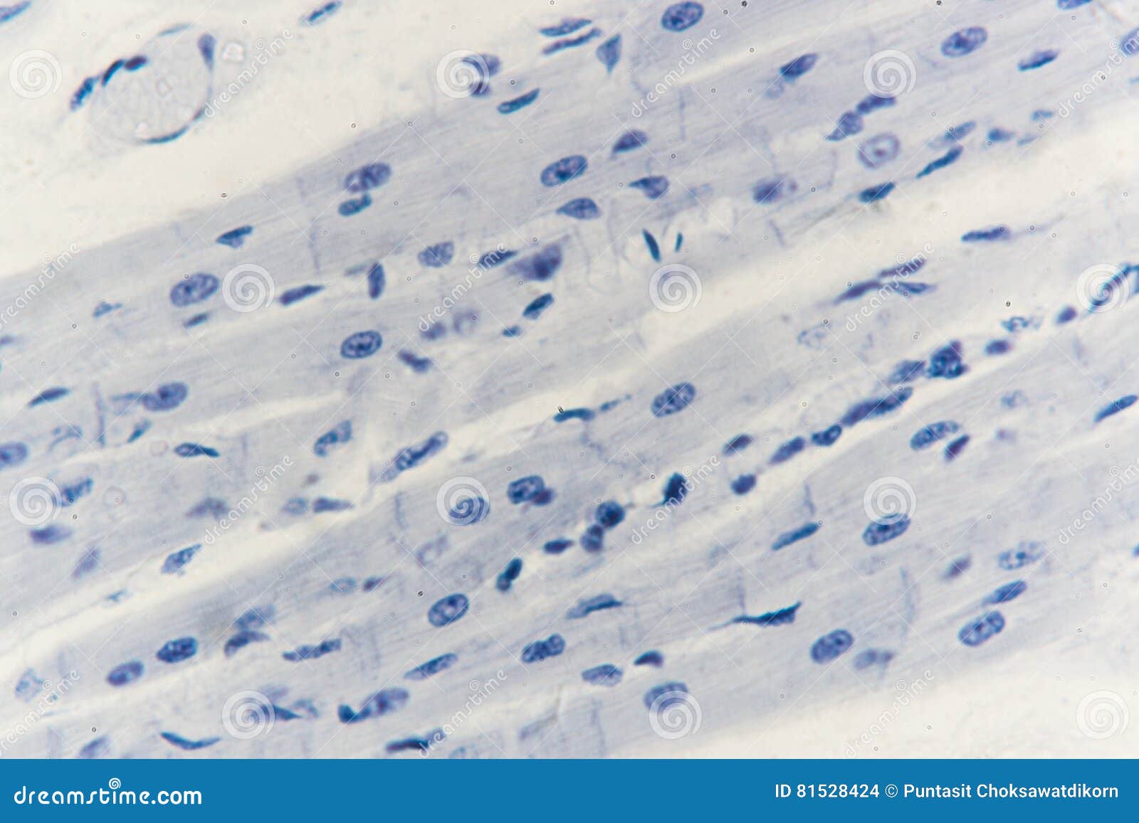 Histology of Cardiac Muscle Stock Photo - Image of cardiac, internal ...