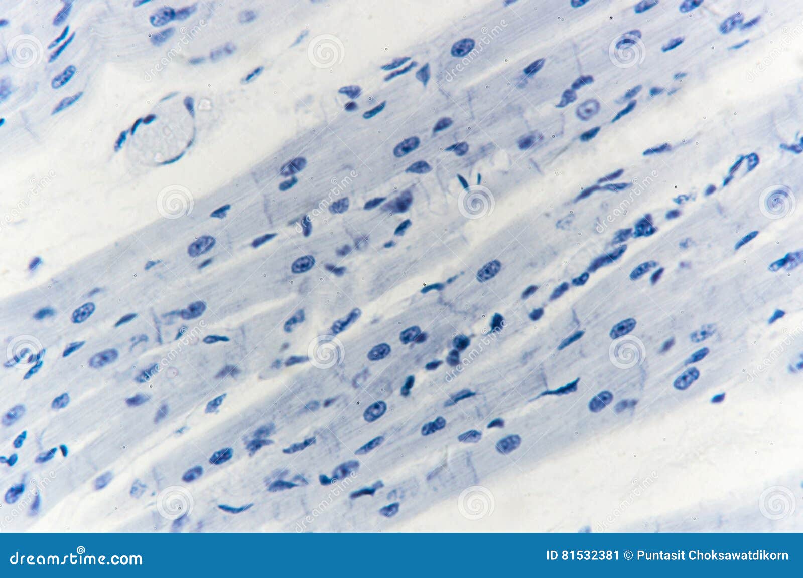 Histology of Cardiac Muscle Stock Image - Image of health, medical ...