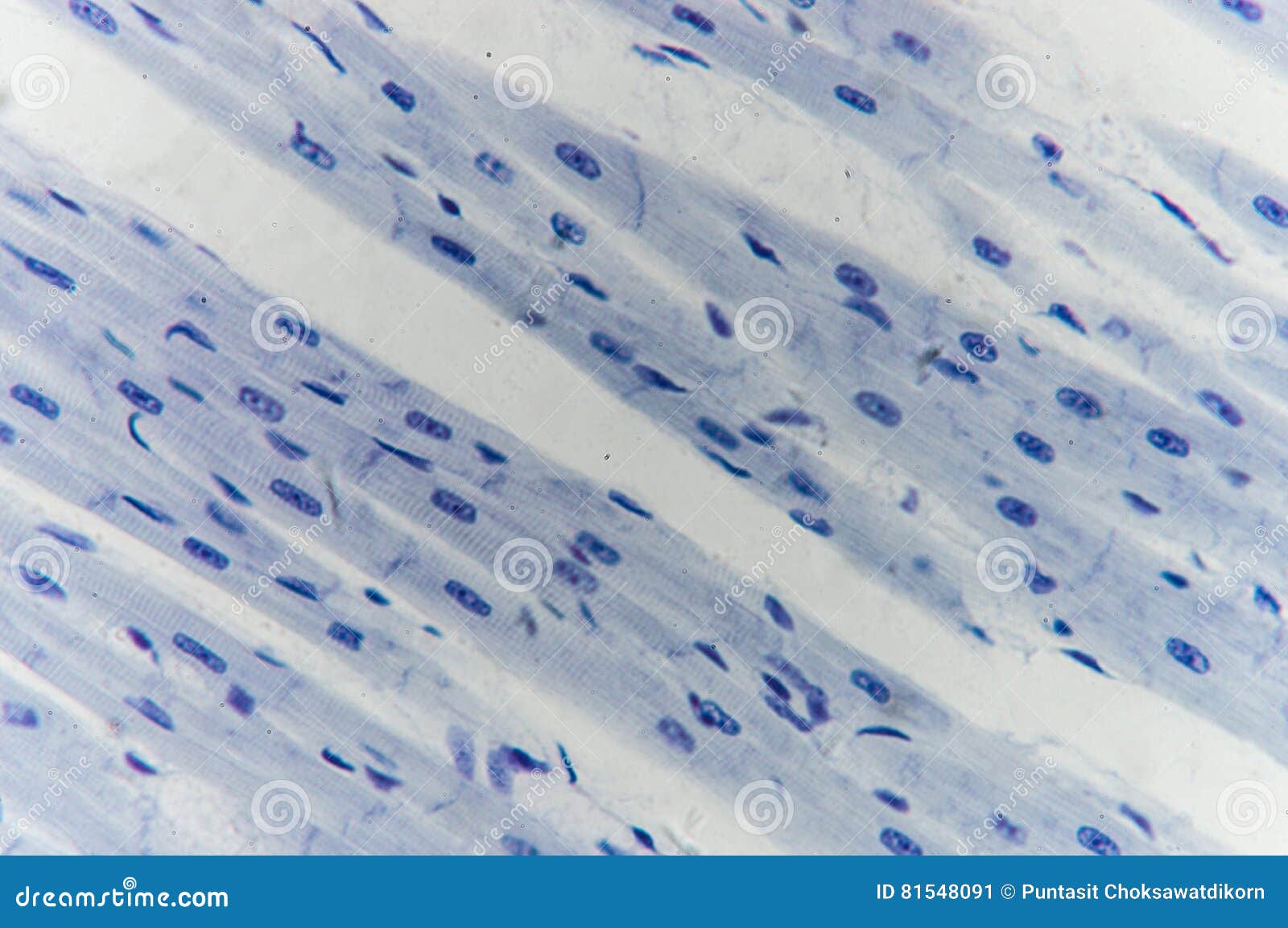 Cardiac Muscle Tissue Slide Labeled