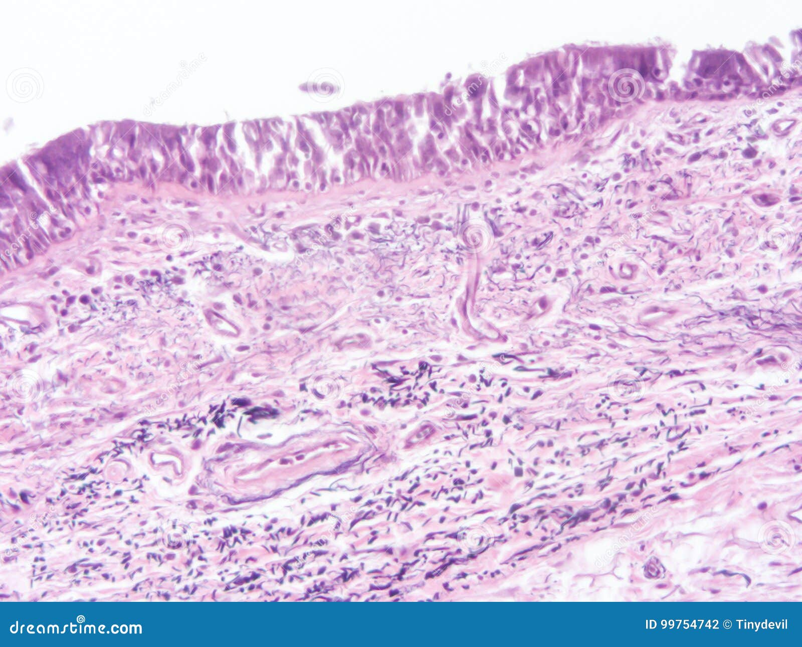 Histology of Cartilage Human Tissue Stock Photo - Image of biology ...
