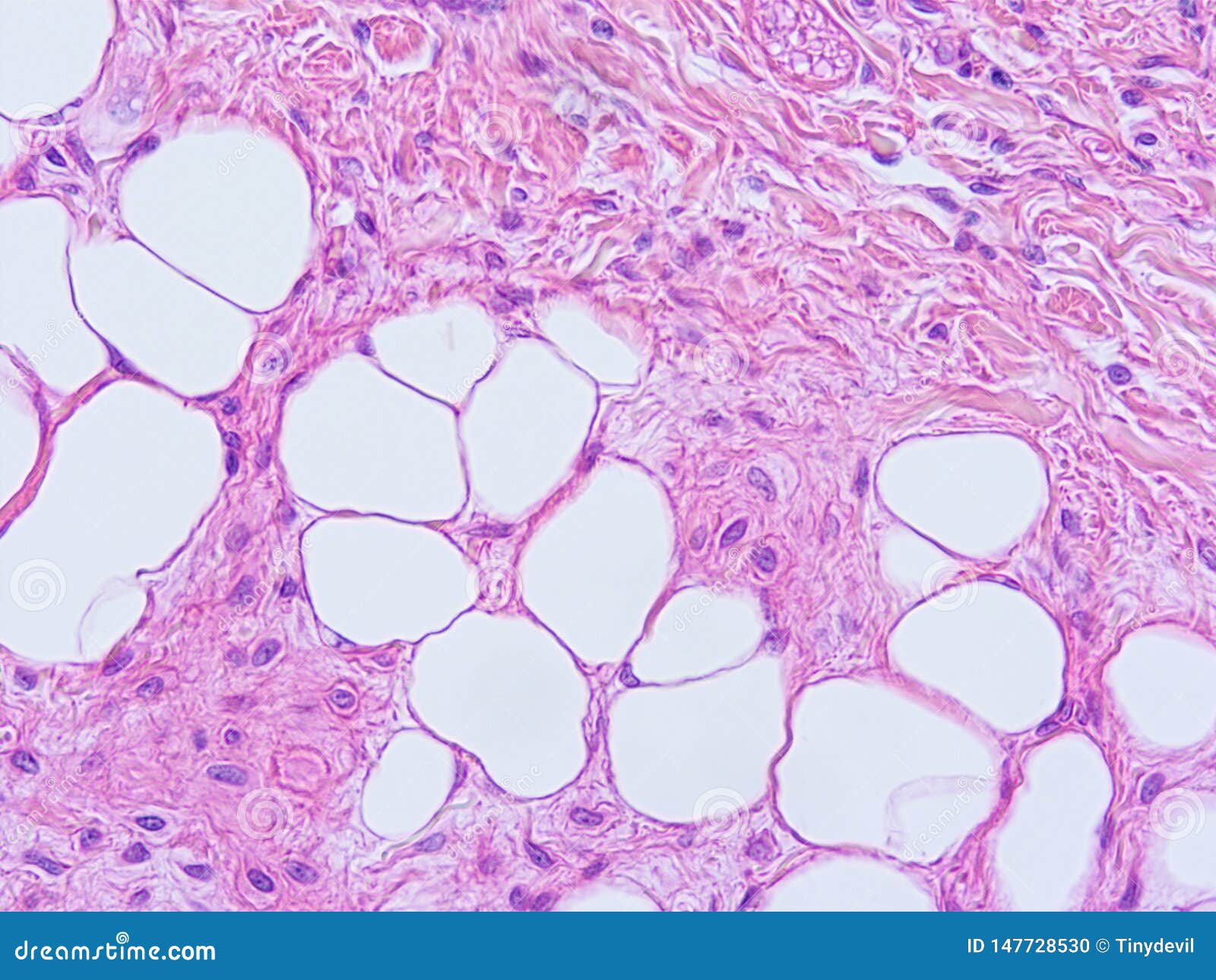 Histology Of Epiglottis Human Tissue Royalty-Free Stock Photography ...