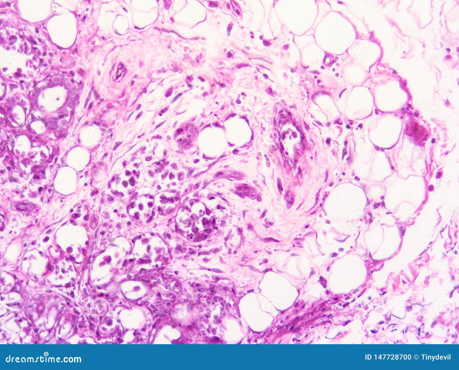 Histology of Epiglottis Human Tissue Stock Photo - Image of health ...