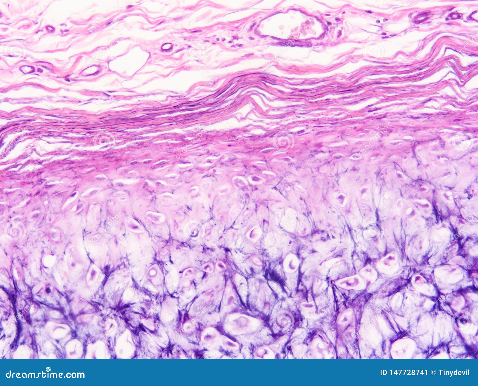 Histology of Epiglottis Human Tissue Stock Image - Image of tendon ...
