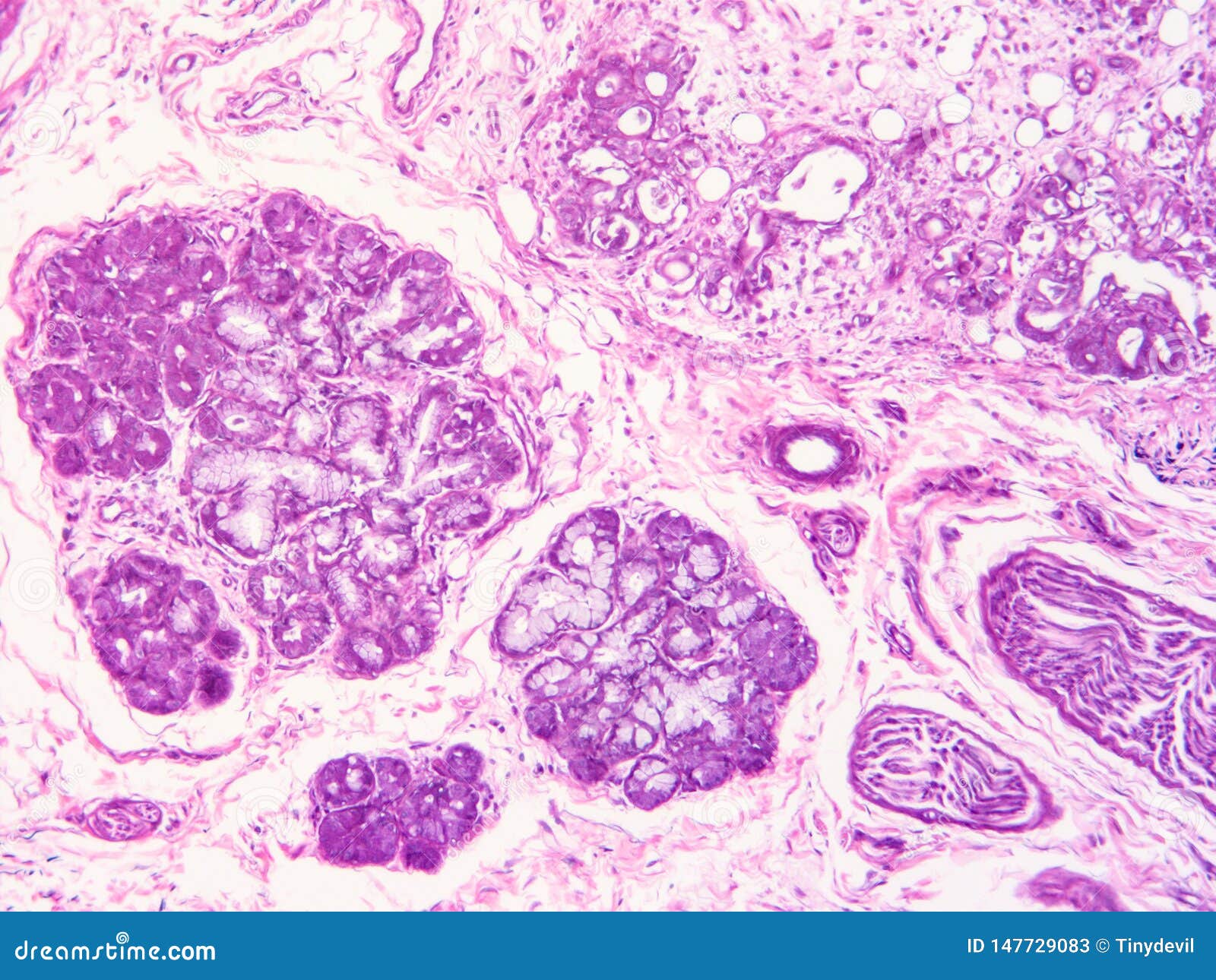 Histology of Epiglottis Human Tissue Stock Image - Image of histology ...