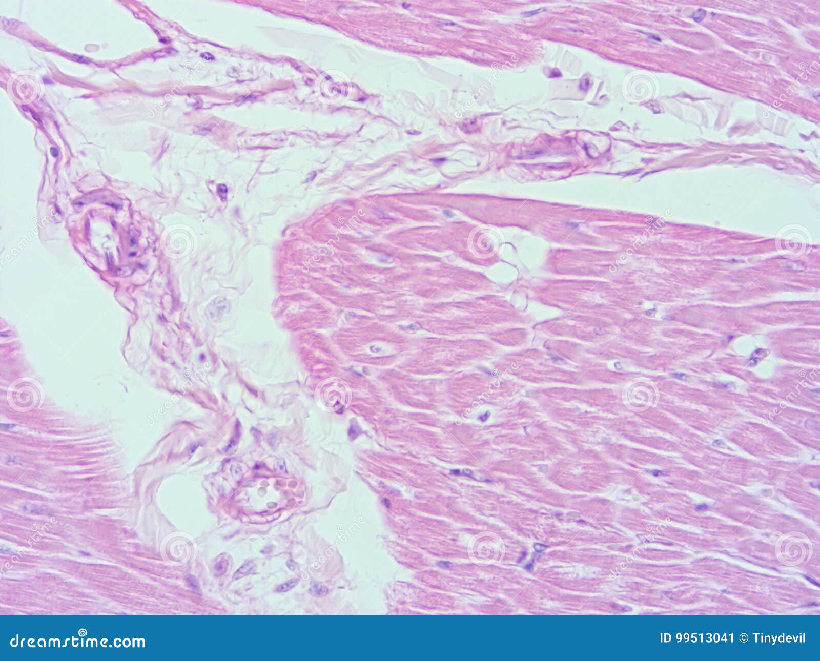 Heart Microscope Slide