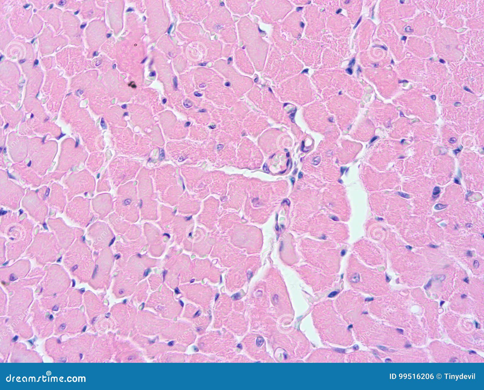 Histology of Heart Human Tissue Stock Photo - Image of cuboidal, muscle ...