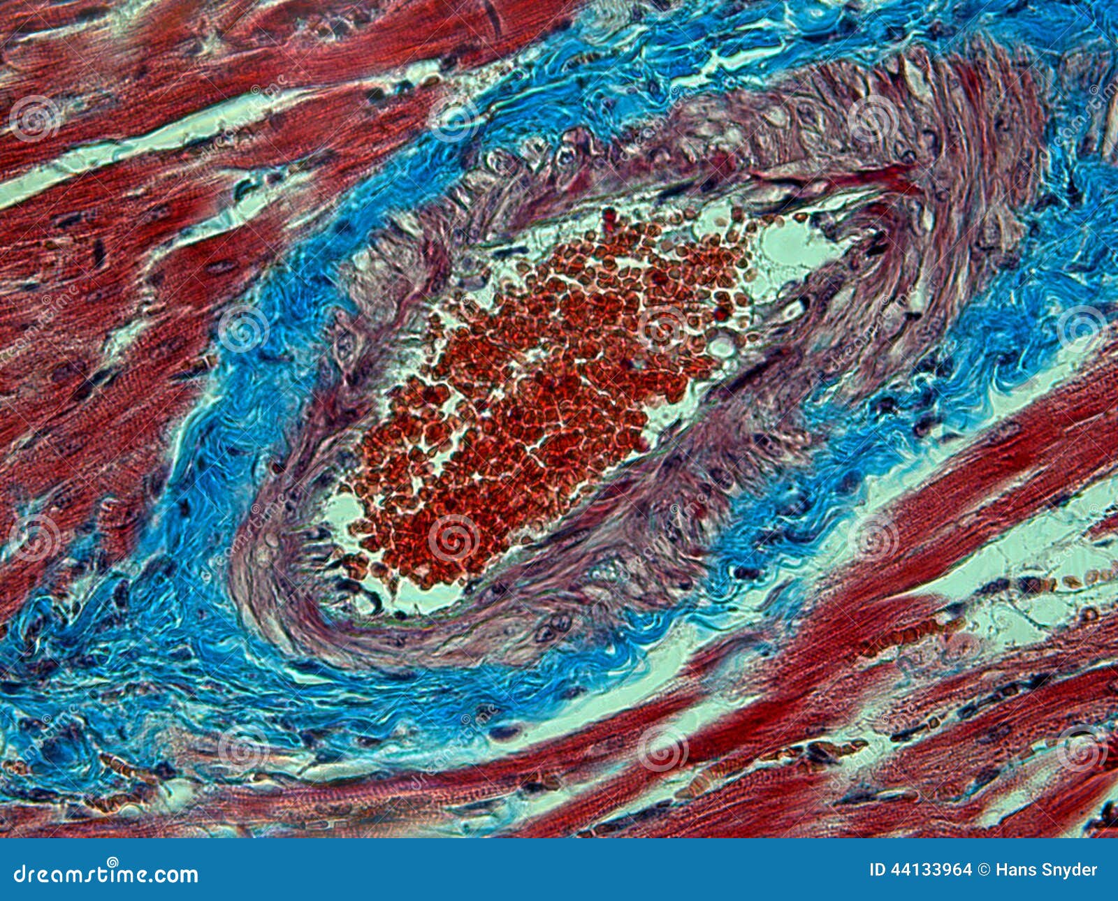 Histology of a Heart stock photo. Image of highlight - 44133964