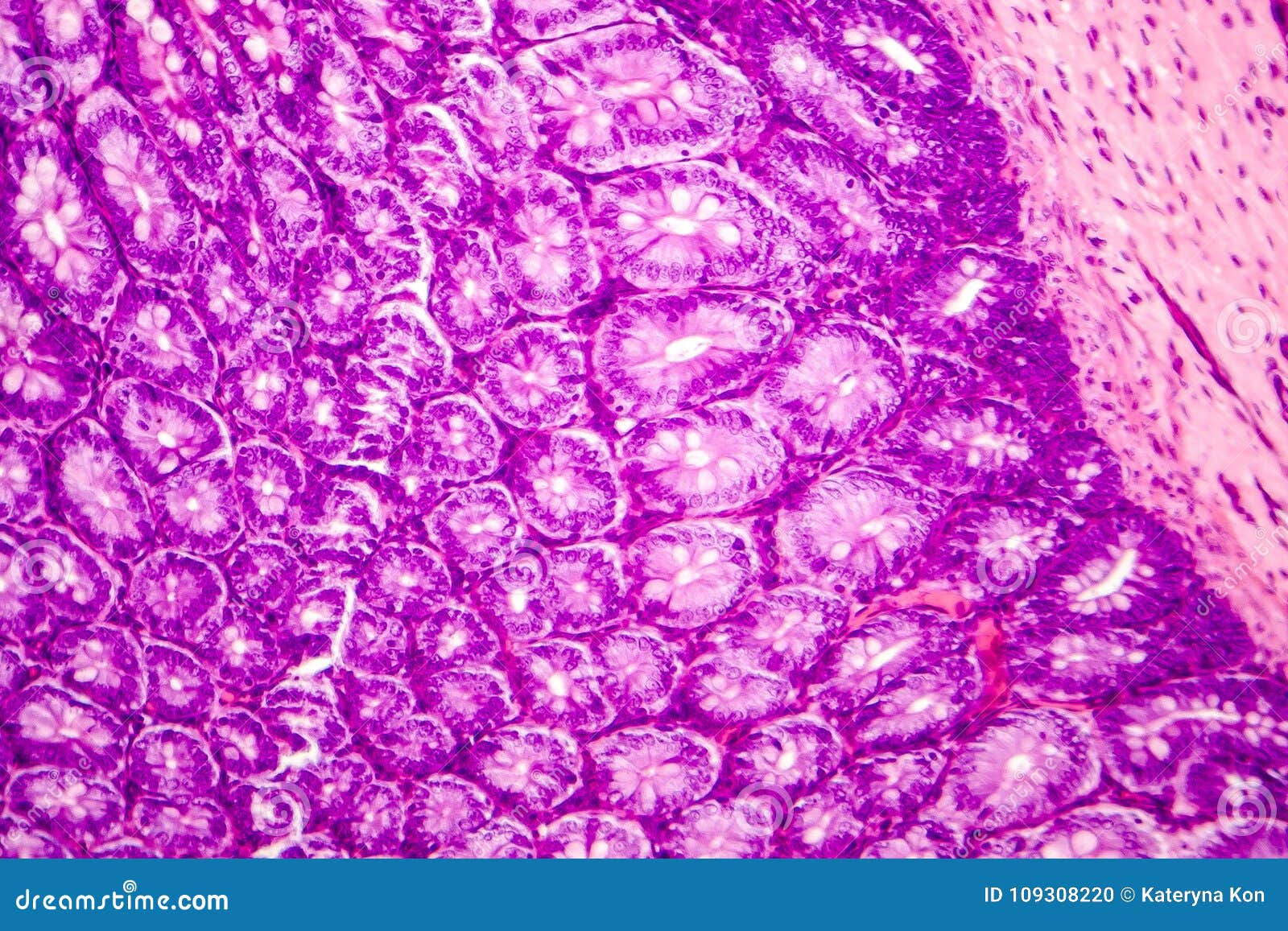 Histology of Human Appendix, Micrograph Showing Crypts of Lieberkuhn ...
